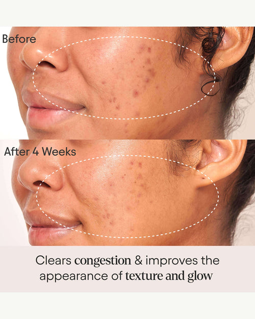 Clarifying Facial Oil with Retinol & Pink Algae – Credo
