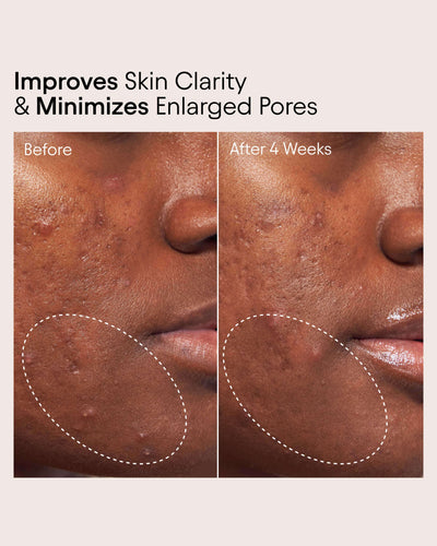 Pore Perfecting Liquid with 2% BHA + Borage – Credo