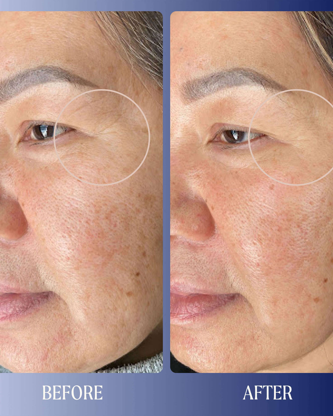 Dreamwave 2% Bio-Retinoid Complex Overnight Serum – Credo