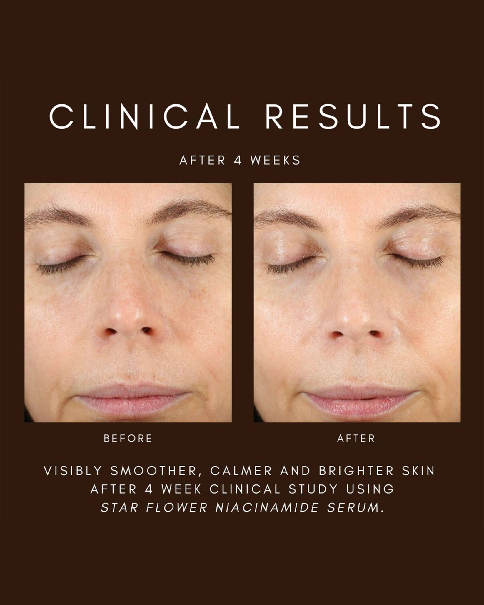 Star Flower Niacinamide Serum – Credo