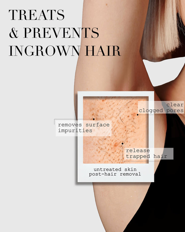 The Ingrown Bar – Credo