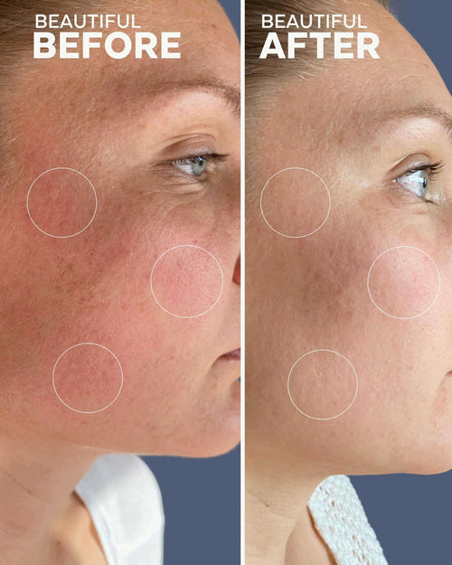 Skin Hero Bakuchiol + Calendula Bio-Retinol Serum – Credo