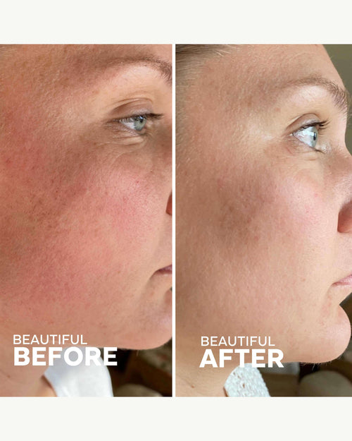 Skin Hero Bakuchiol + Calendula Bio-Retinol Serum – Credo