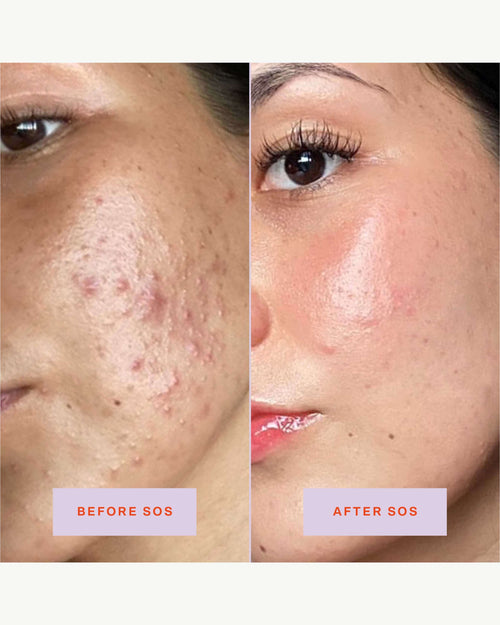 Shop Save. Our. Skin Daily Rescue Facial Spray – Credo Beauty