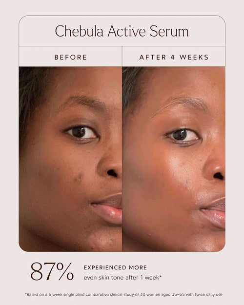 Chebula Active Anti-Aging Serum – Credo