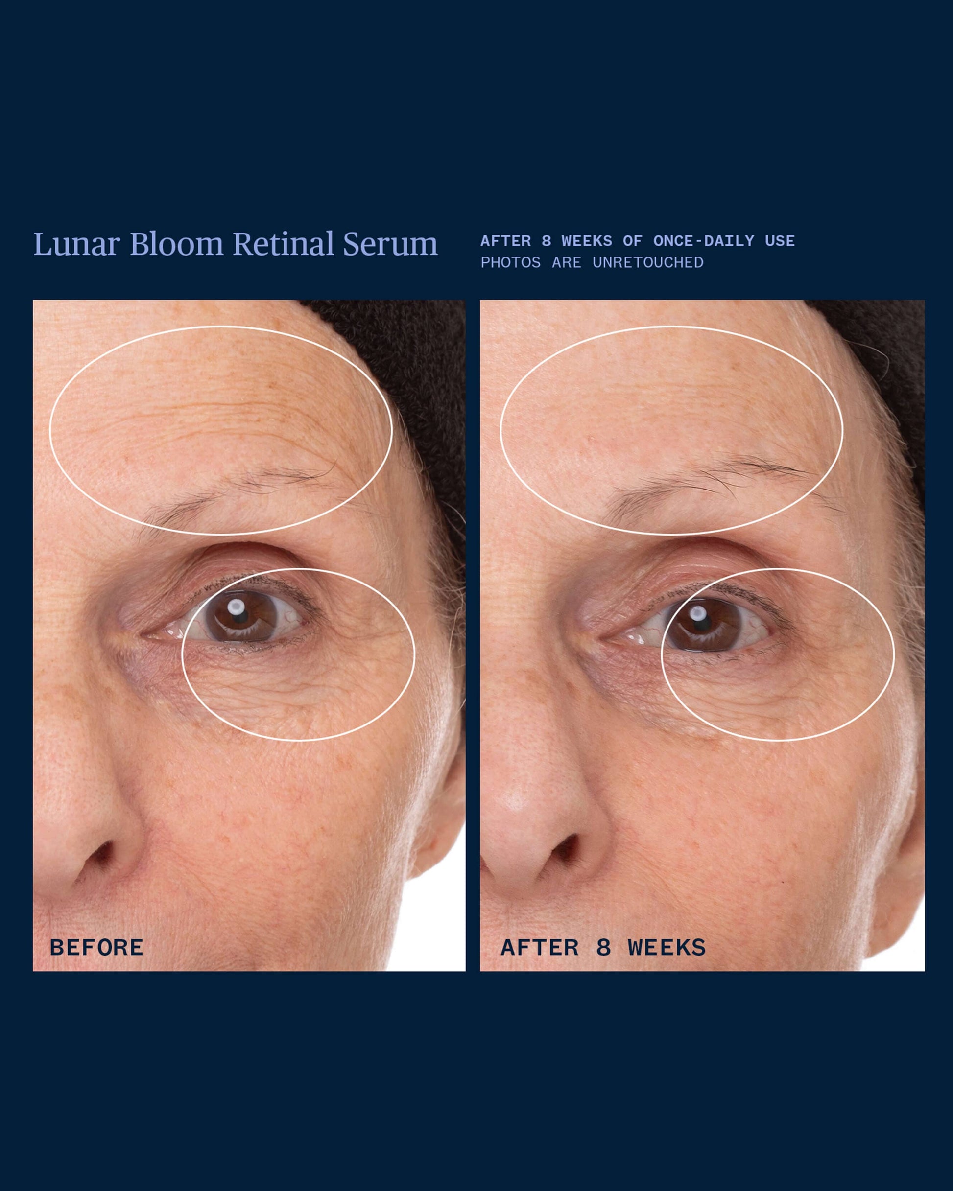Lunar Bloom Retinal Serum – Credo